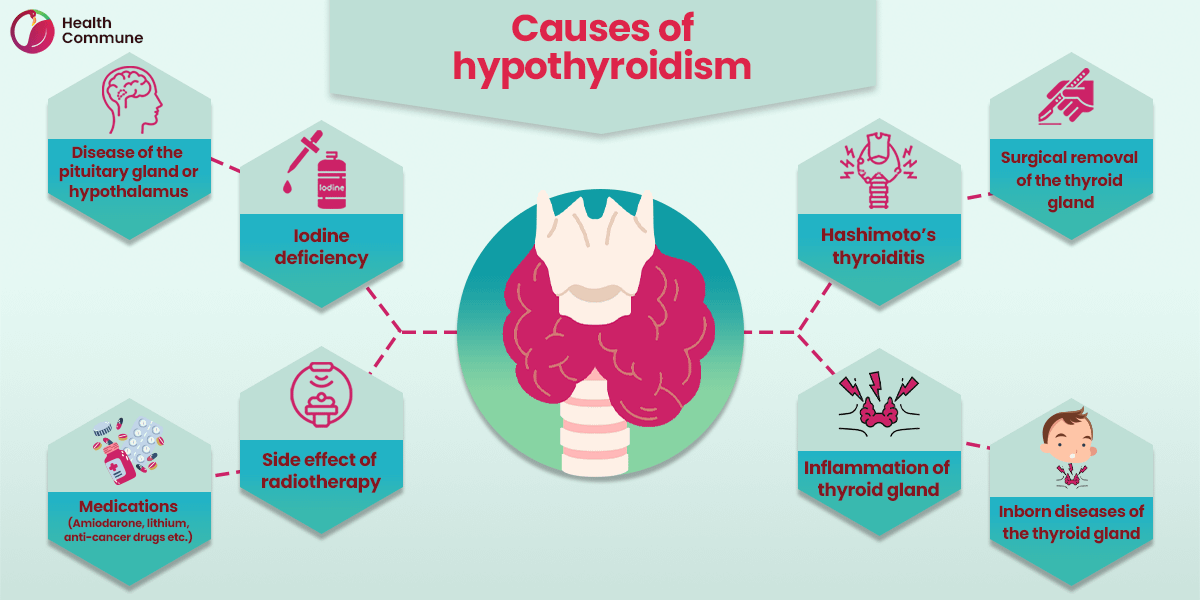 Hypothyroidism: Here’s everything you need to know - Health Commune