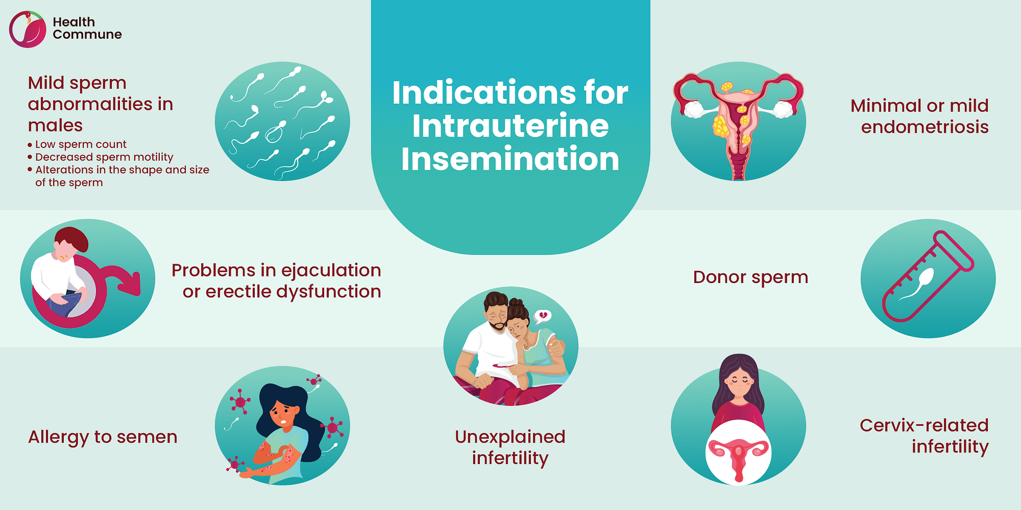 Intrauterine insemination (IUI): Facts you should know - Health Commune