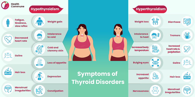 A quick guide to the thyroid gland, thyroid hormones and thyroid ...